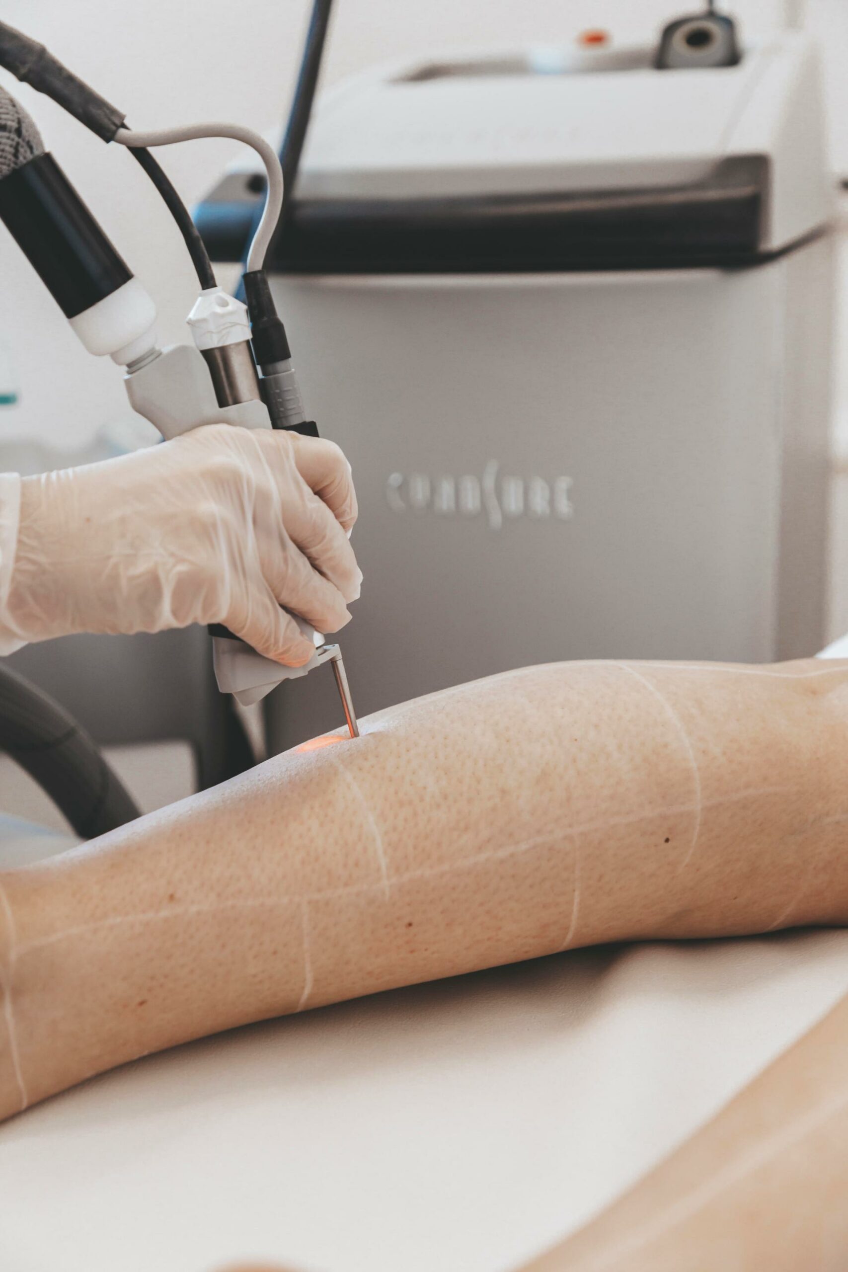 Laser hair removal - True Skin & Laser